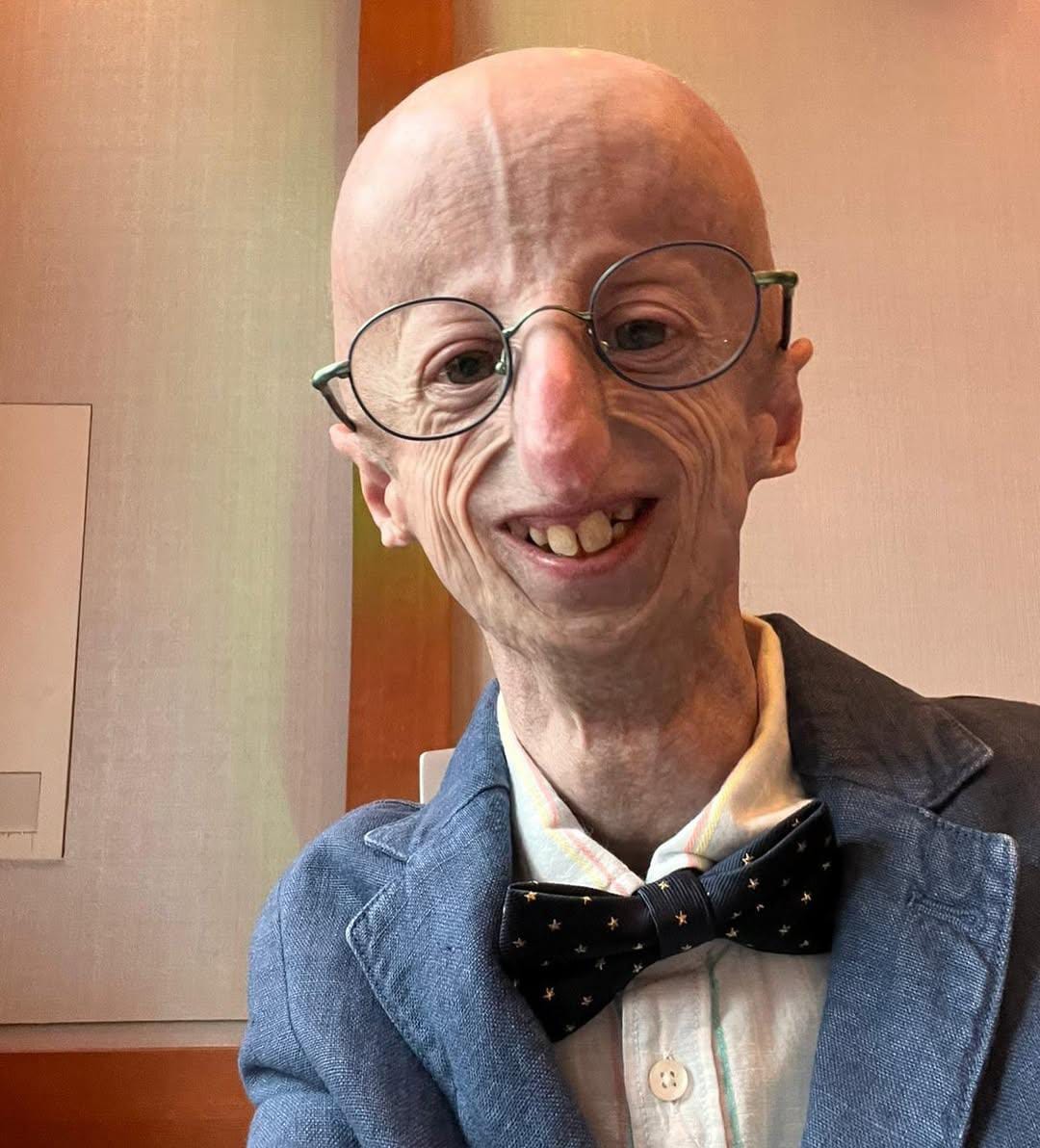 Fallece Sammy Basso, el científico italiano que visibilizó la progeria ...